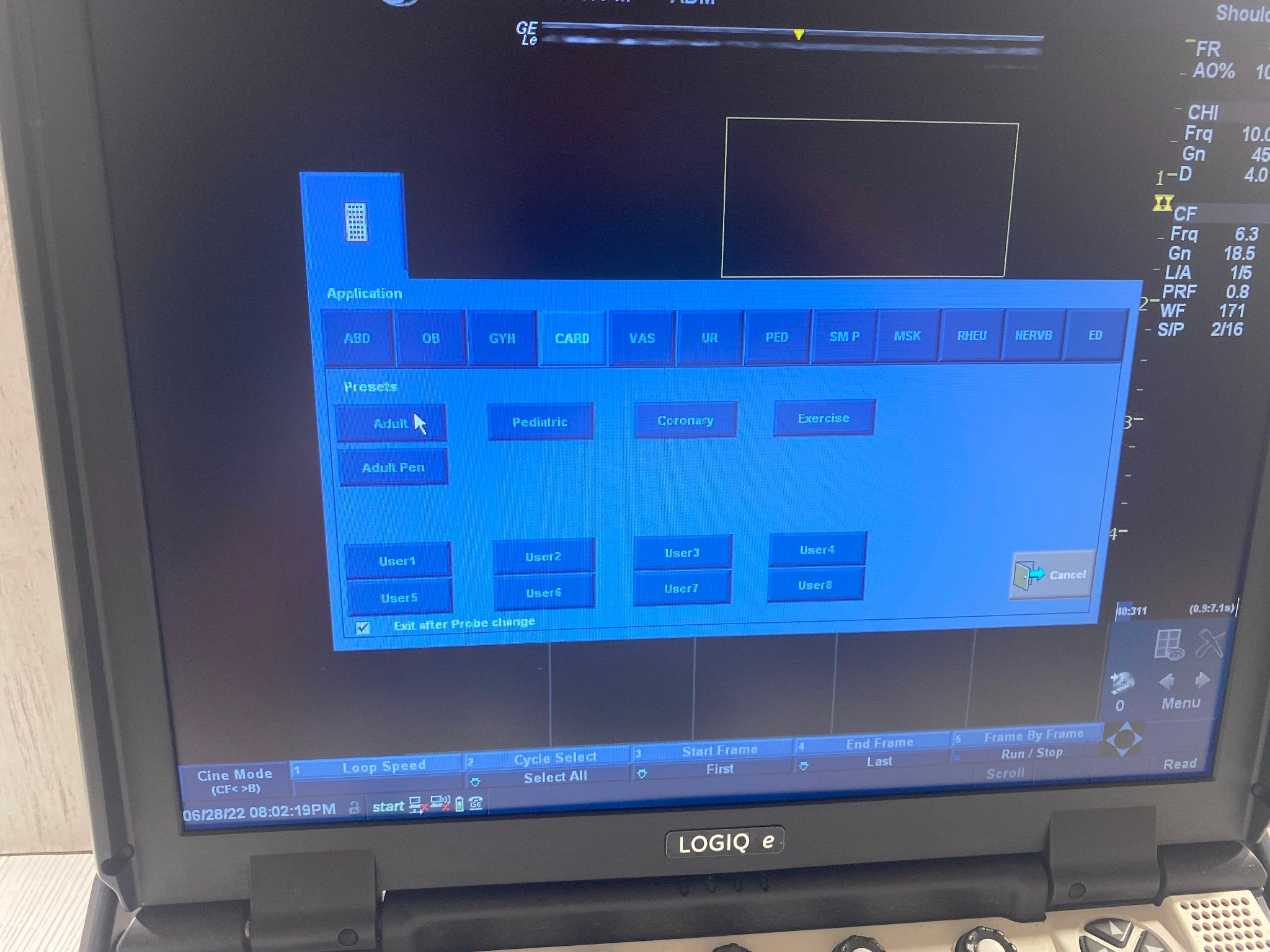 GE LOGIQ E Next Generation Ultrasound machine & Probe -L4-12T DOM 2014 ...