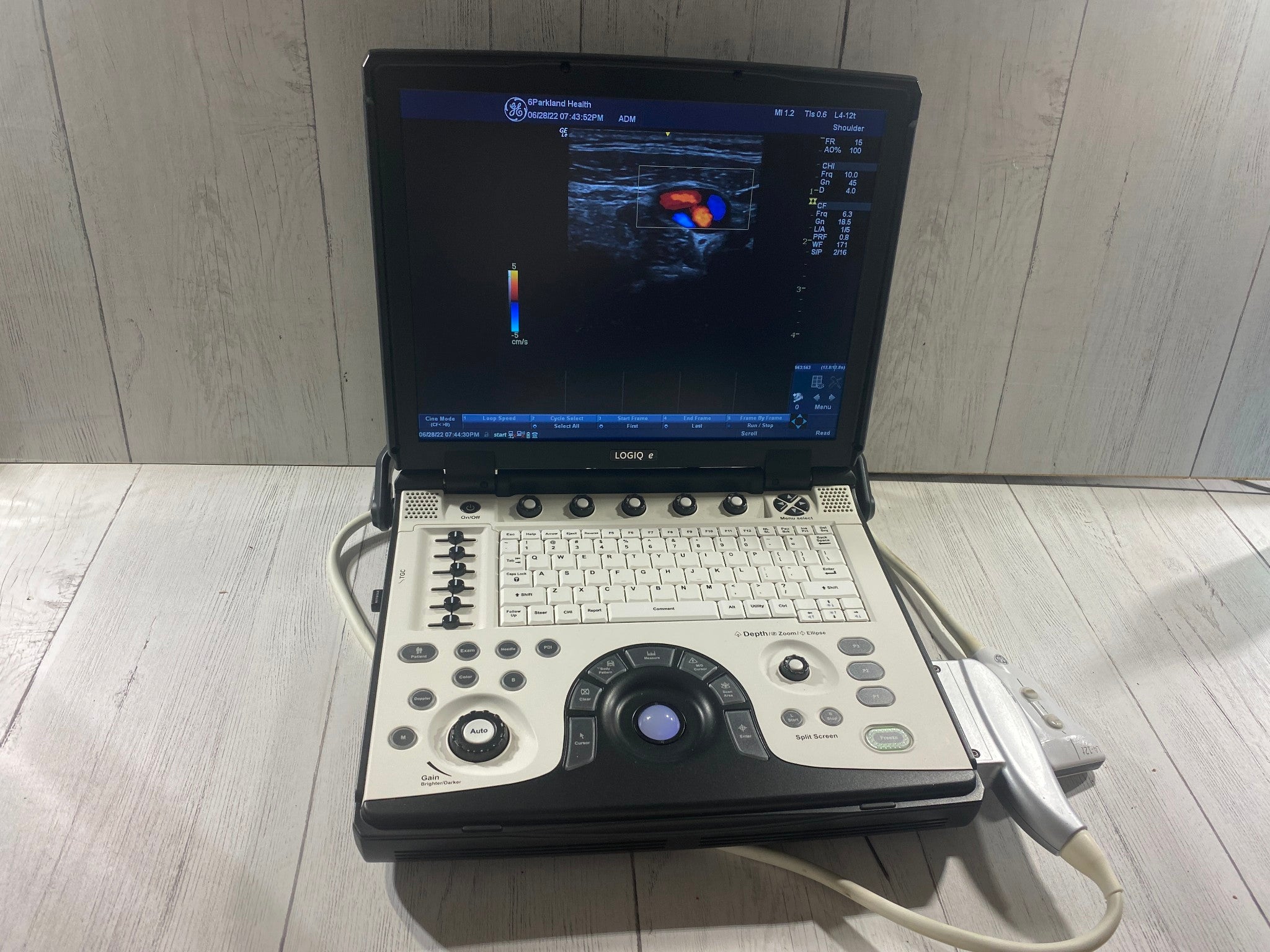 GE LOGIQ E Next Generation Ultrasound machine & Probe -L4-12T DOM 2014 ...